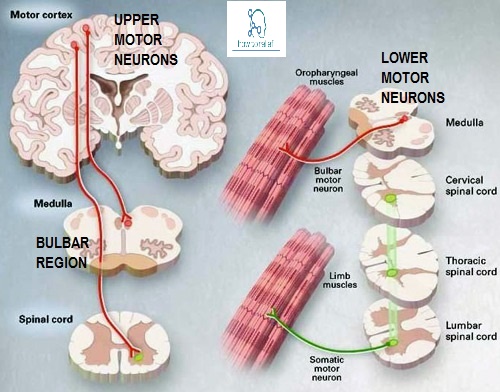 Upper Motor vs. Lower Motor Neuron Disease » How To Relief Upper Motor vs. Lower Motor Neuron Disease » How To Relief